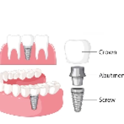 Resite.link - malligaidental